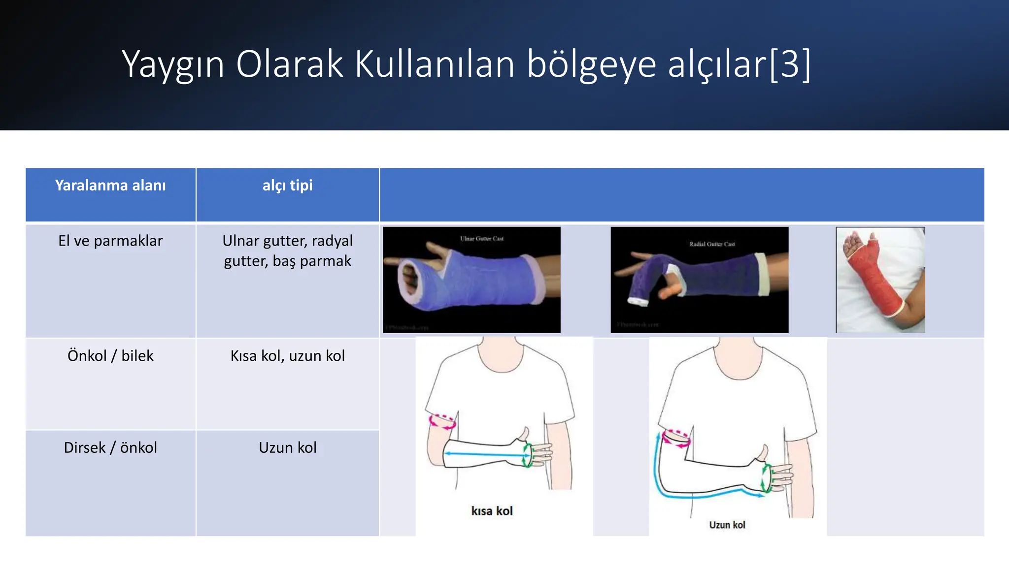 upper limb casting | PPT