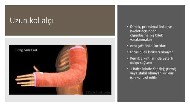 upper limb casting | PPT
