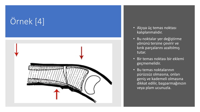 upper limb casting | PPT