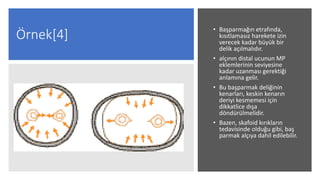 upper limb casting | PPT