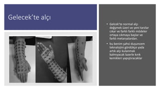 upper limb casting | PPT