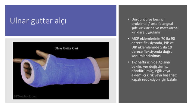 upper limb casting | PPT