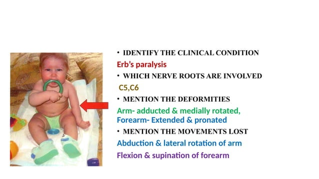 UPPER LIMB CLINICAL CHARTS MBBS FIRST YEAR | PPT