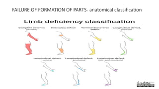UPPER LIMB DEFECTS- failure of formation of parts.pptx