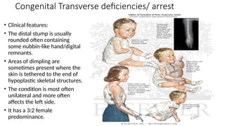 UPPER LIMB DEFECTS- failure of formation of parts.pptx
