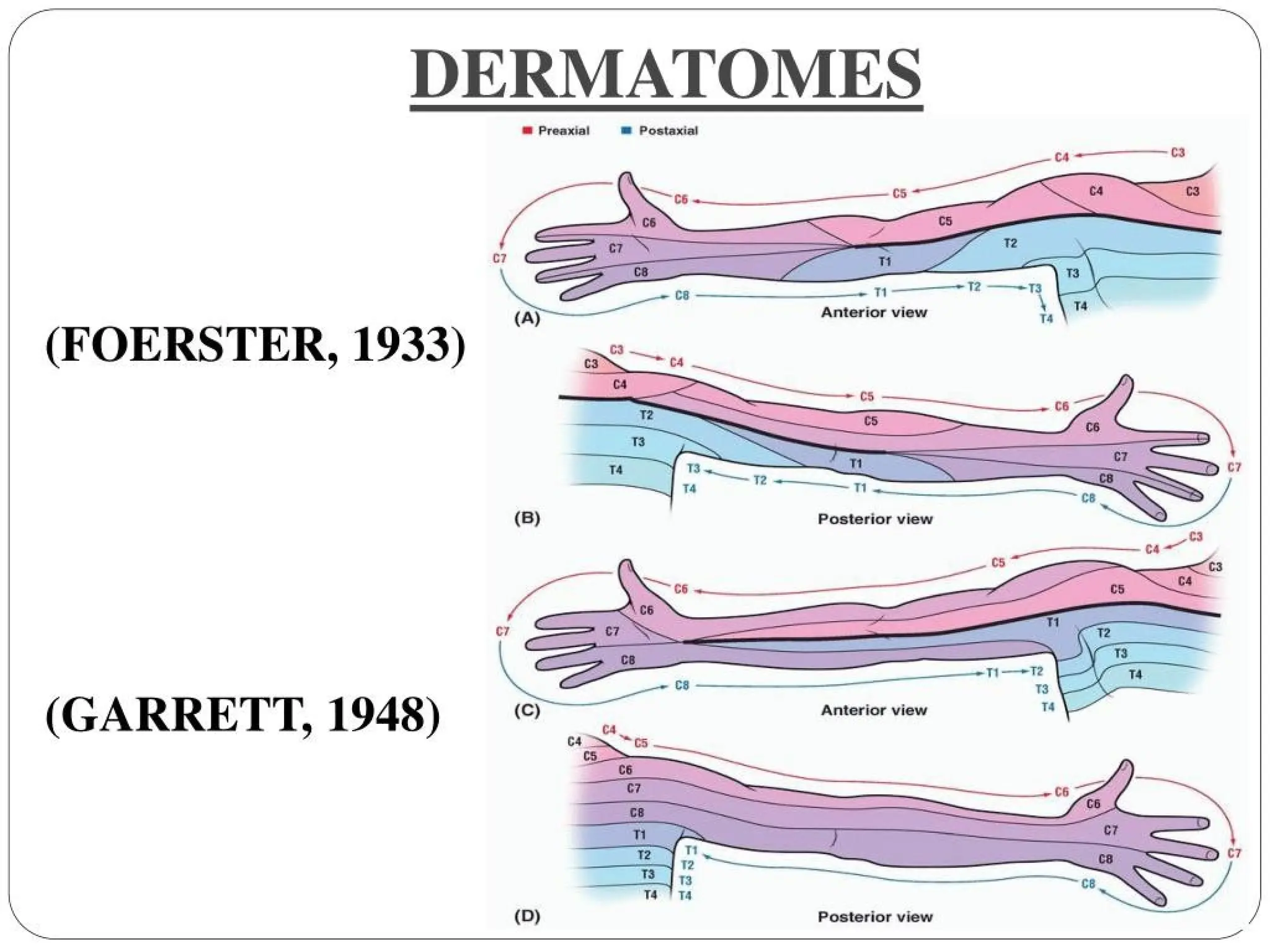 UPPER LIMB DERMATOMES AND THEIR CLINICAL SIGNIFICANCE. pptx | PPTX