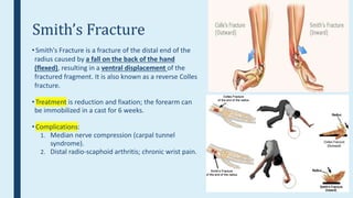 Upper limb fractures | PPTX