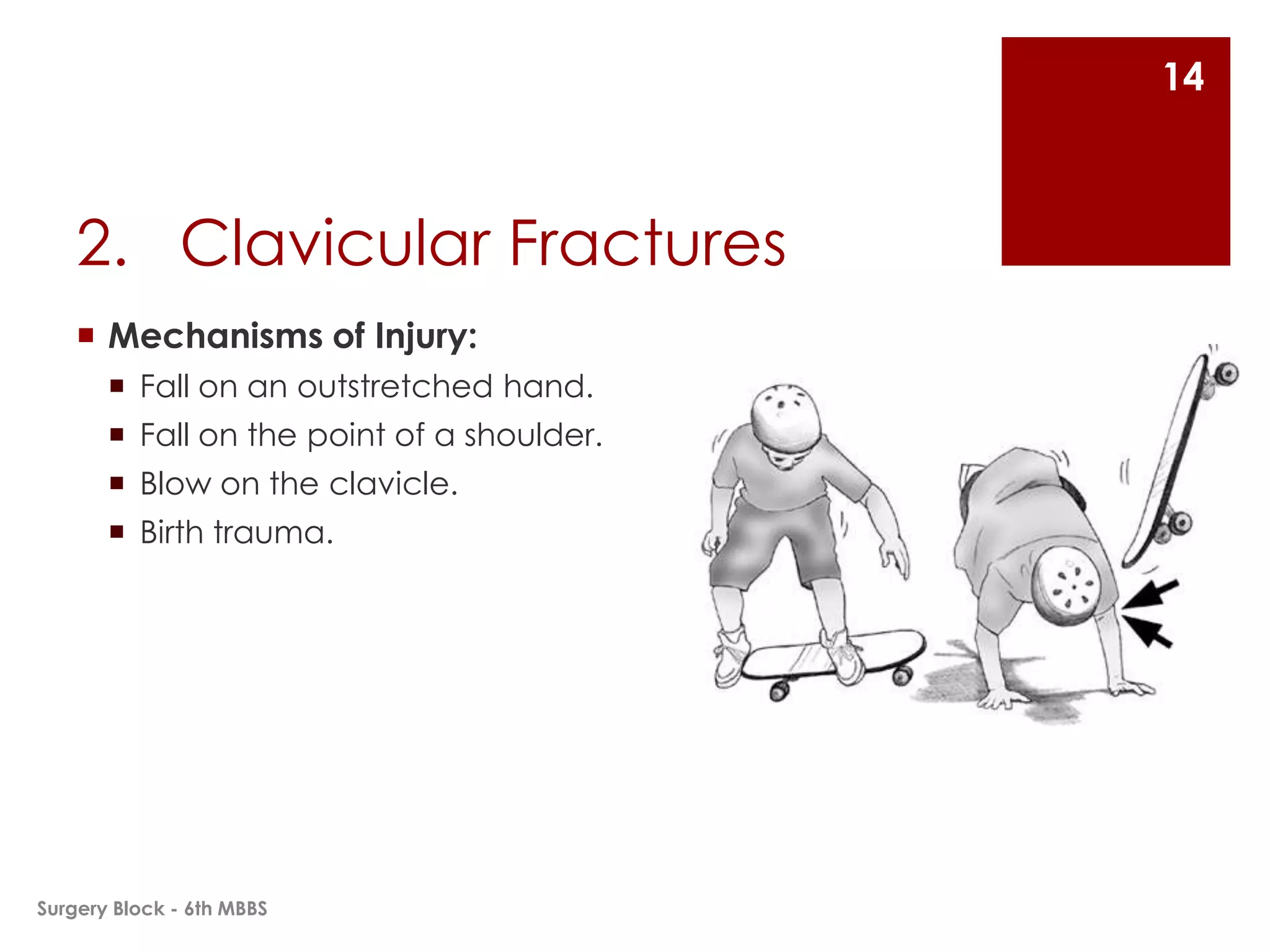 Fractures and Dislocations of Upper Limb | PPTX