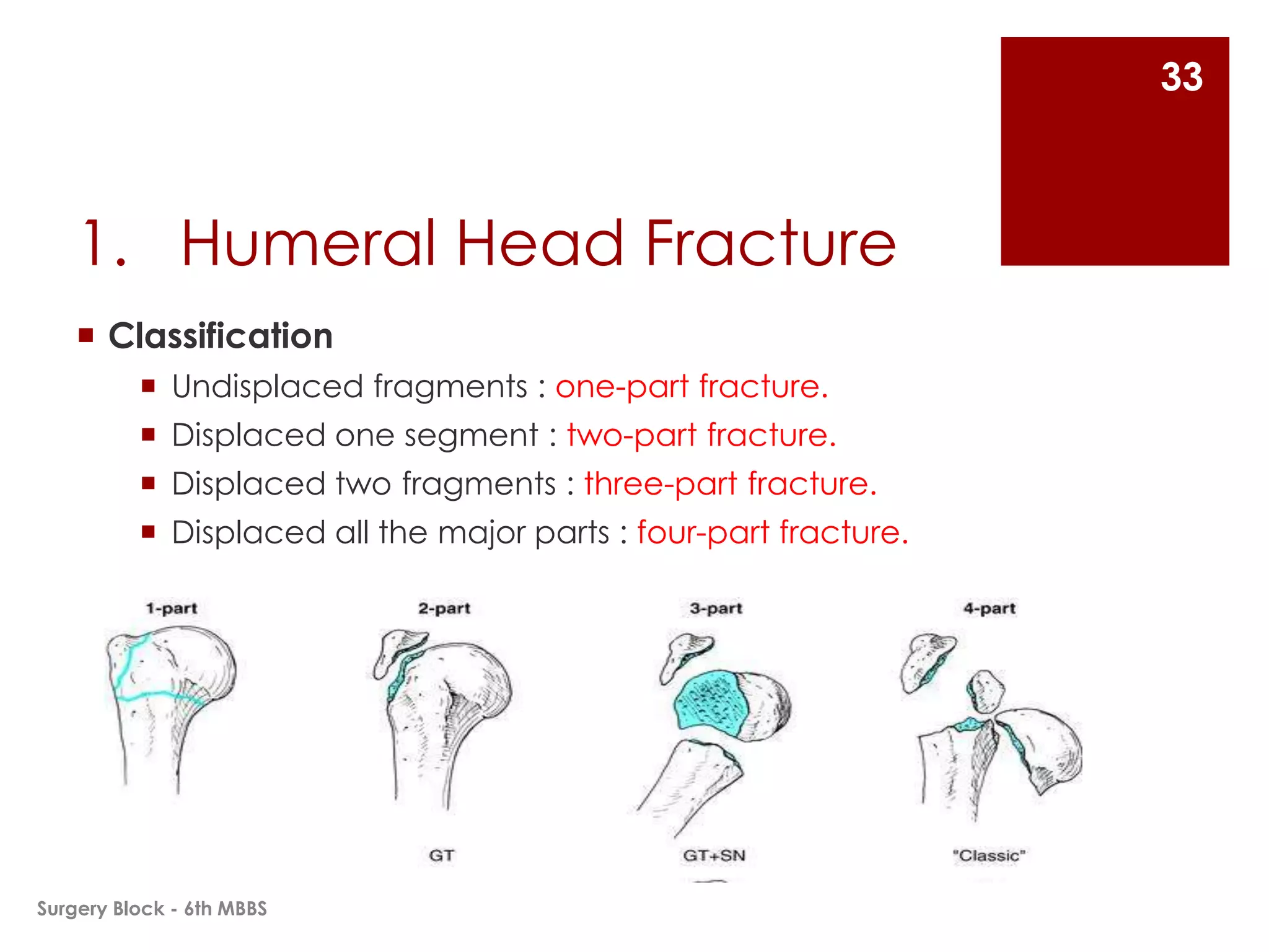 Fractures and Dislocations of Upper Limb | PPTX