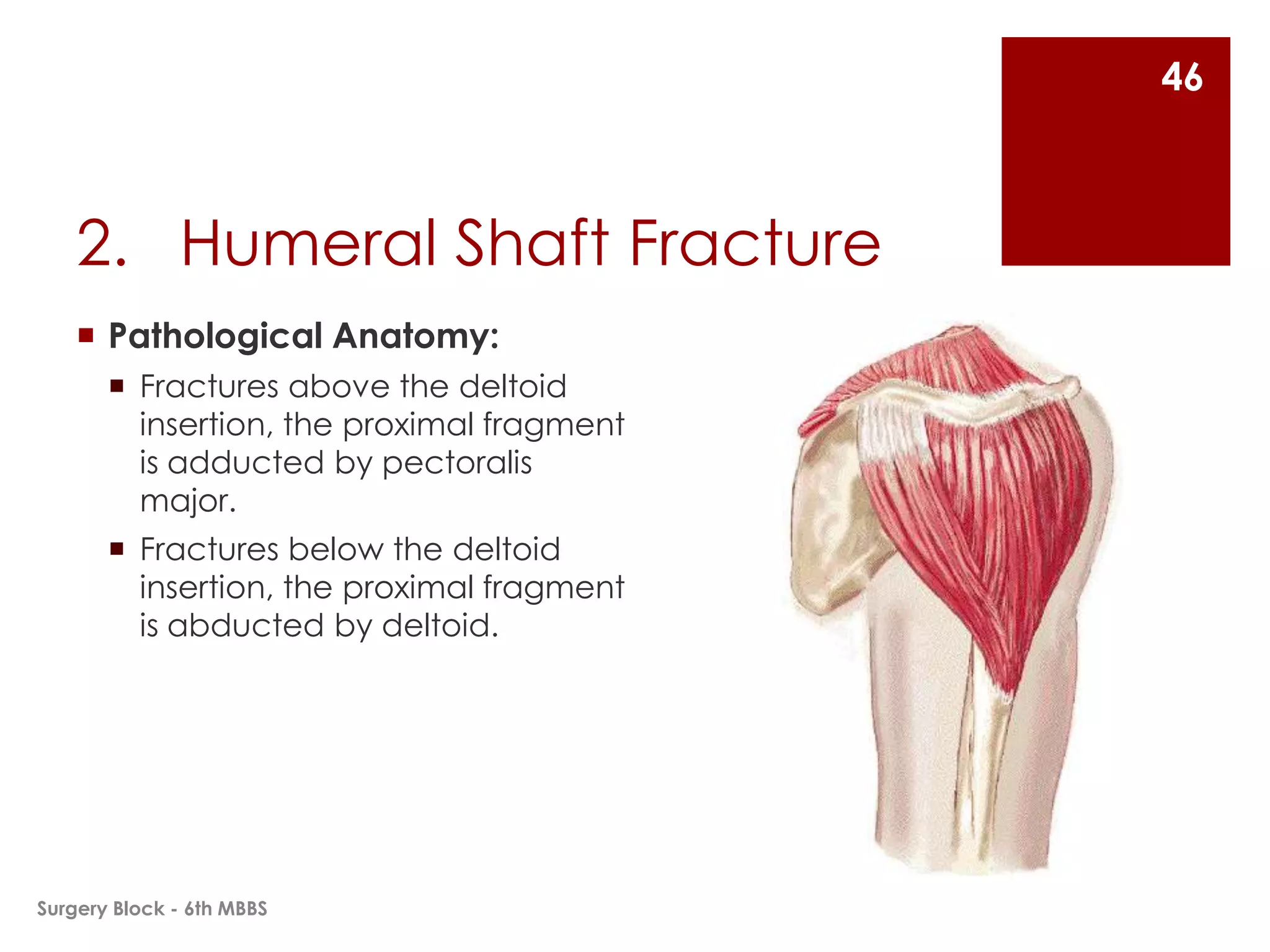 Fractures and Dislocations of Upper Limb | PPTX