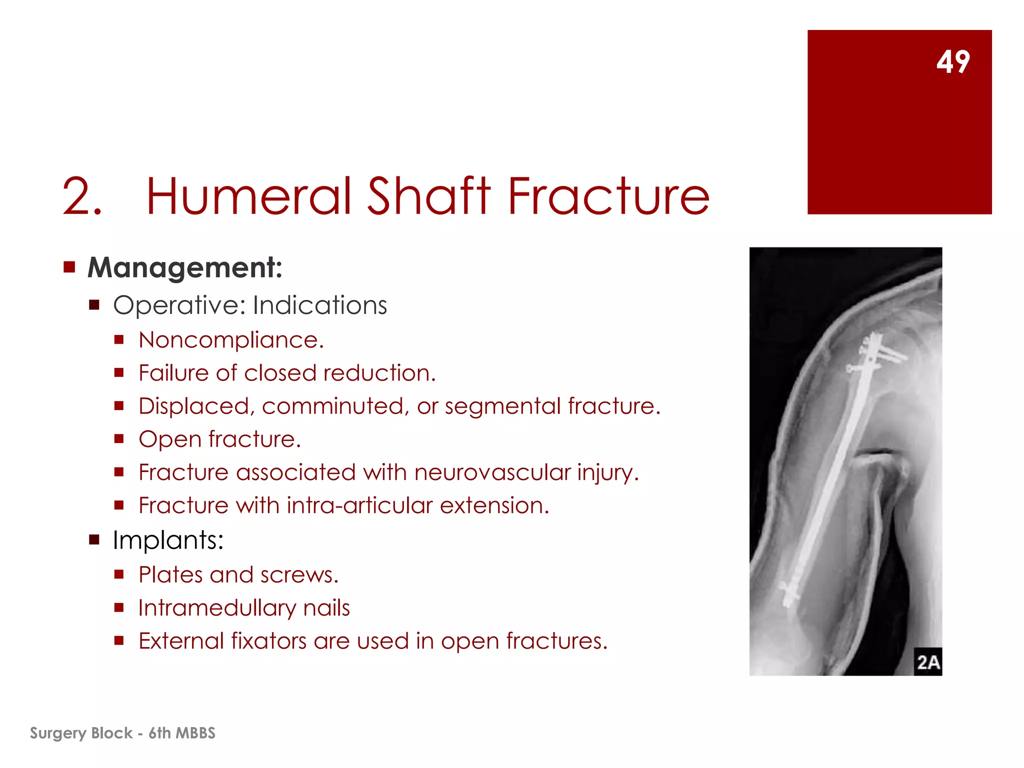 Fractures and Dislocations of Upper Limb | PPTX