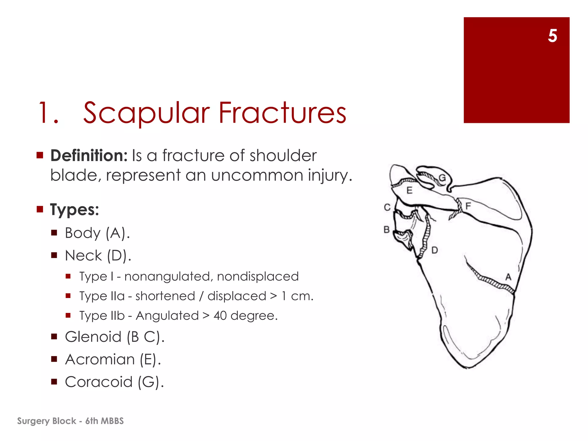 Fractures and Dislocations of Upper Limb | PPTX