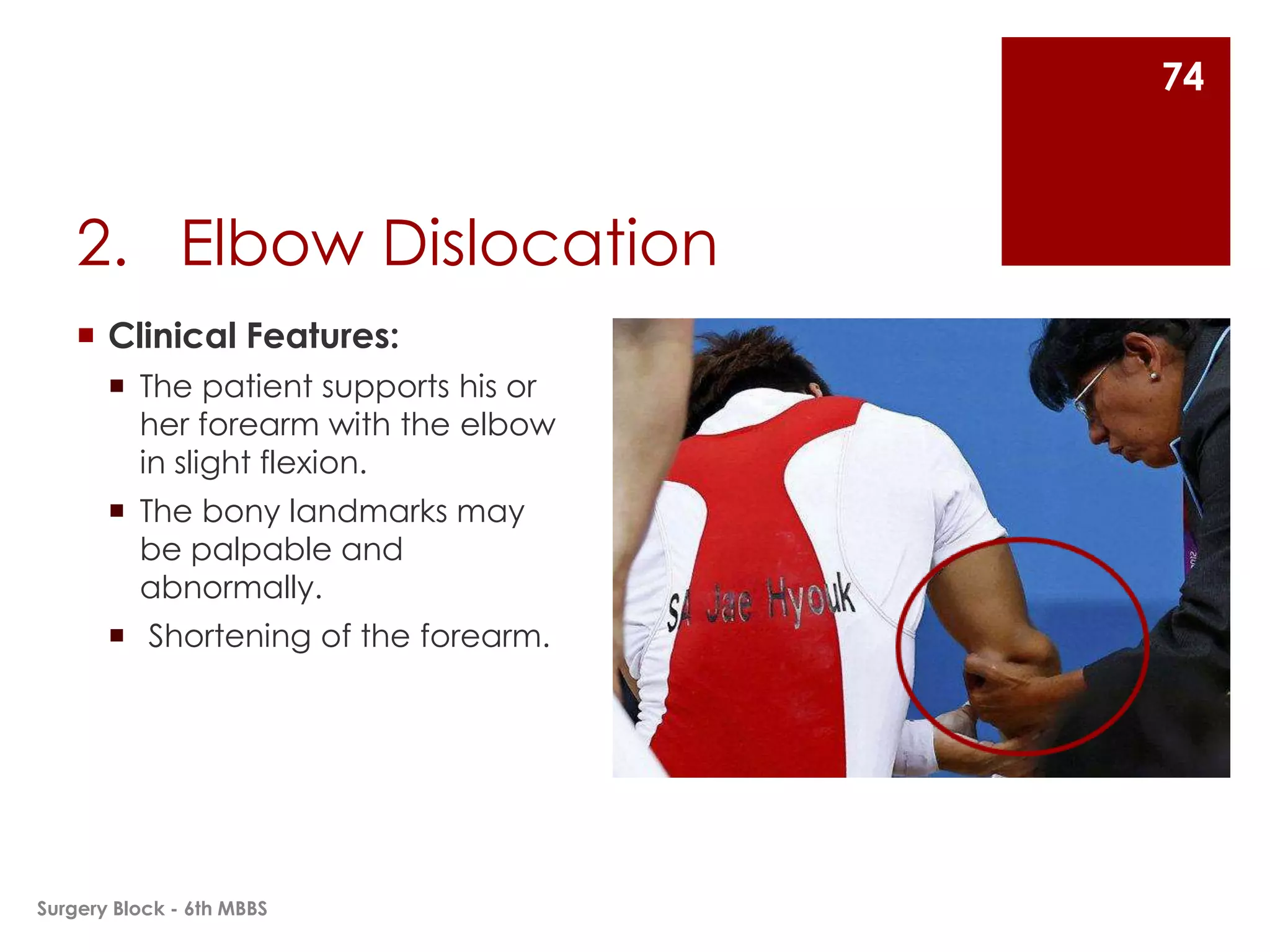Fractures and Dislocations of Upper Limb | PPTX