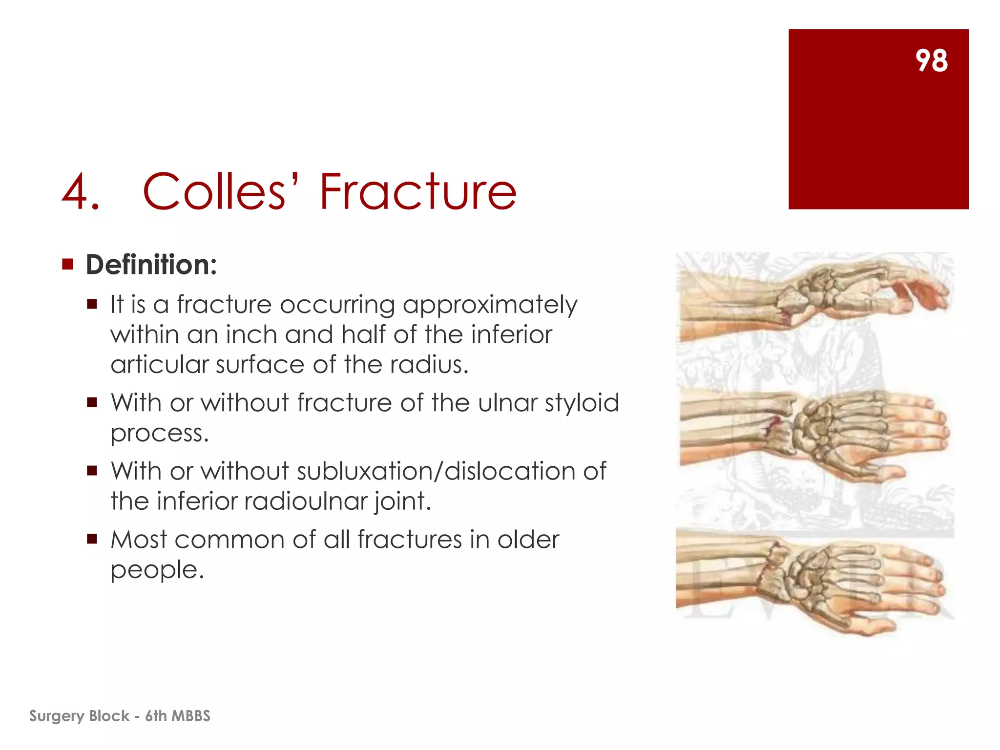 Fractures and Dislocations of Upper Limb | PPTX