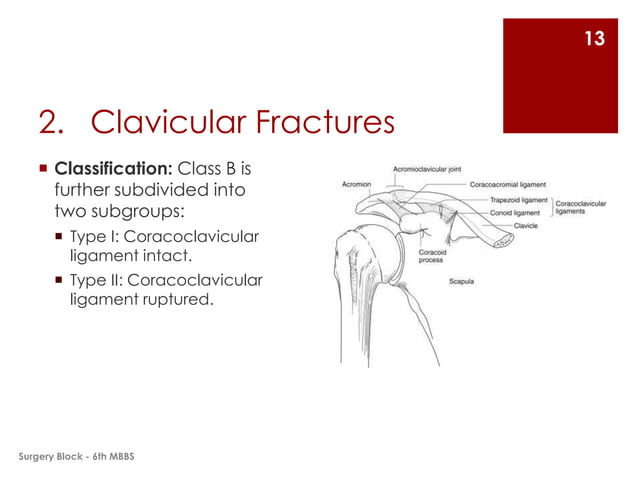 Fractures and Dislocations of Upper Limb | PPTX