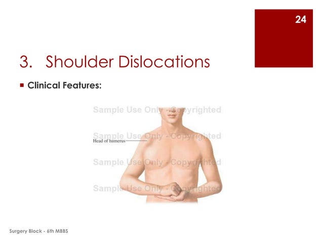 Fractures and Dislocations of Upper Limb | PPTX