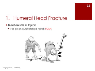 Fractures and Dislocations of Upper Limb | PPTX