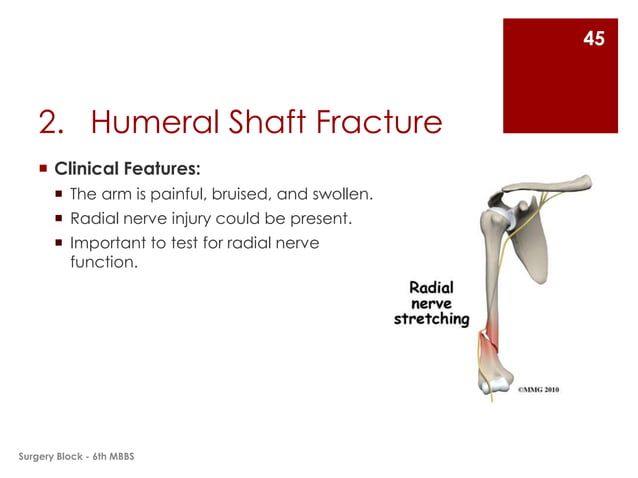 Fractures and Dislocations of Upper Limb | PPTX