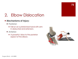 Fractures and Dislocations of Upper Limb | PPTX
