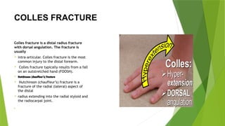 Upper limb fractures presentation and management | PPTX