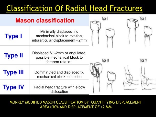 Upper limb fractures (part2)