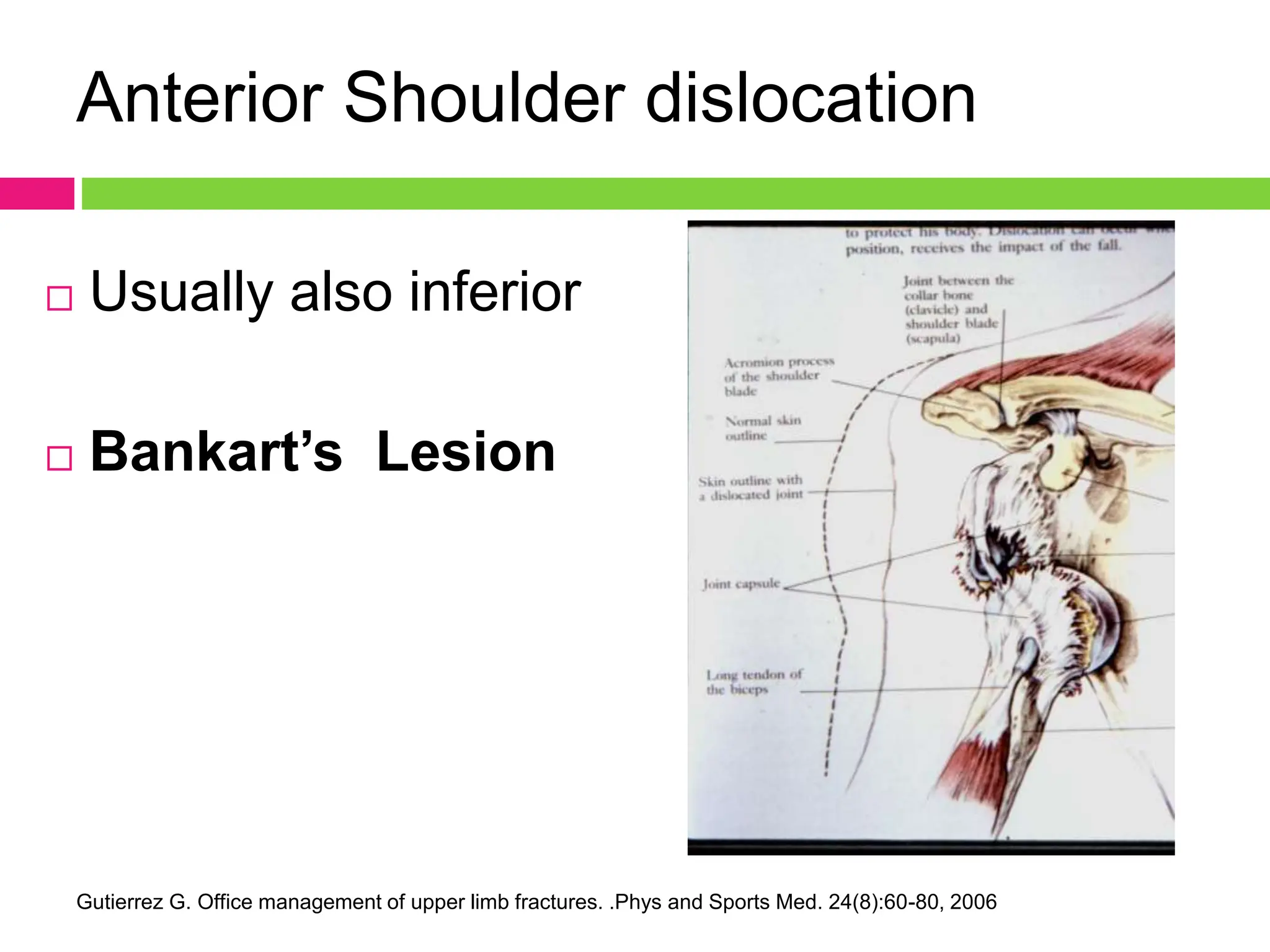 Upper_limb_injuries_x_raysjBqbbsbdhns.ppt