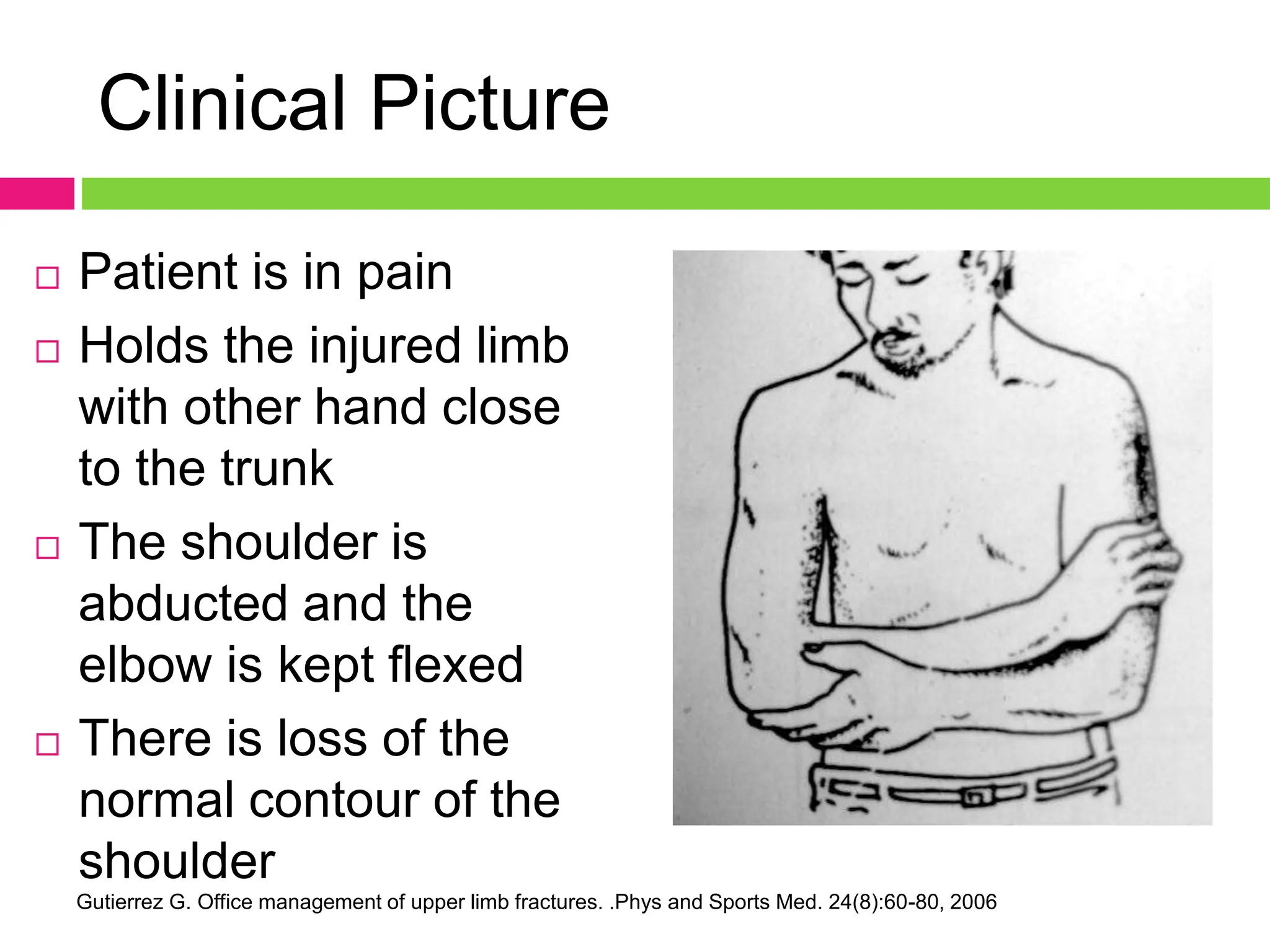 Upper_limb_injuries_x_raysjBqbbsbdhns.ppt