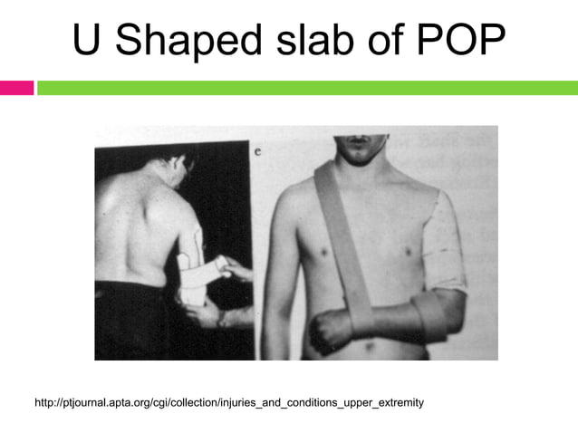 Upper_limb_injuries_x_raysjBqbbsbdhns.ppt