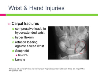 Upper_limb_injuries_x_raysjBqbbsbdhns.ppt