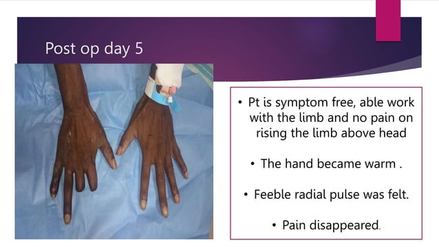 UPPER LIMB ISCHAEMIA.pptx