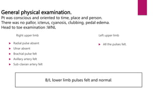 UPPER LIMB ISCHAEMIA.pptx