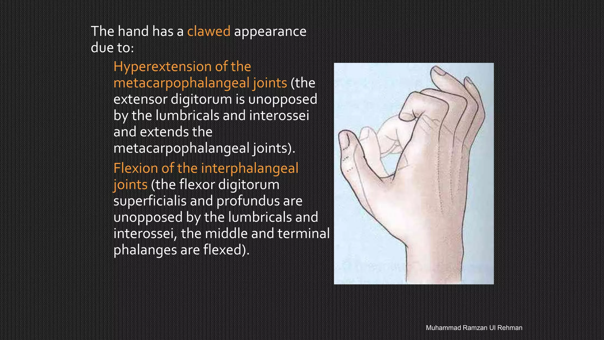 Upper limb nerve injuries | PPT