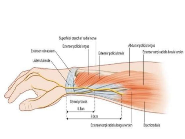 upper limb nerve injuries caused , presentation | PPTX