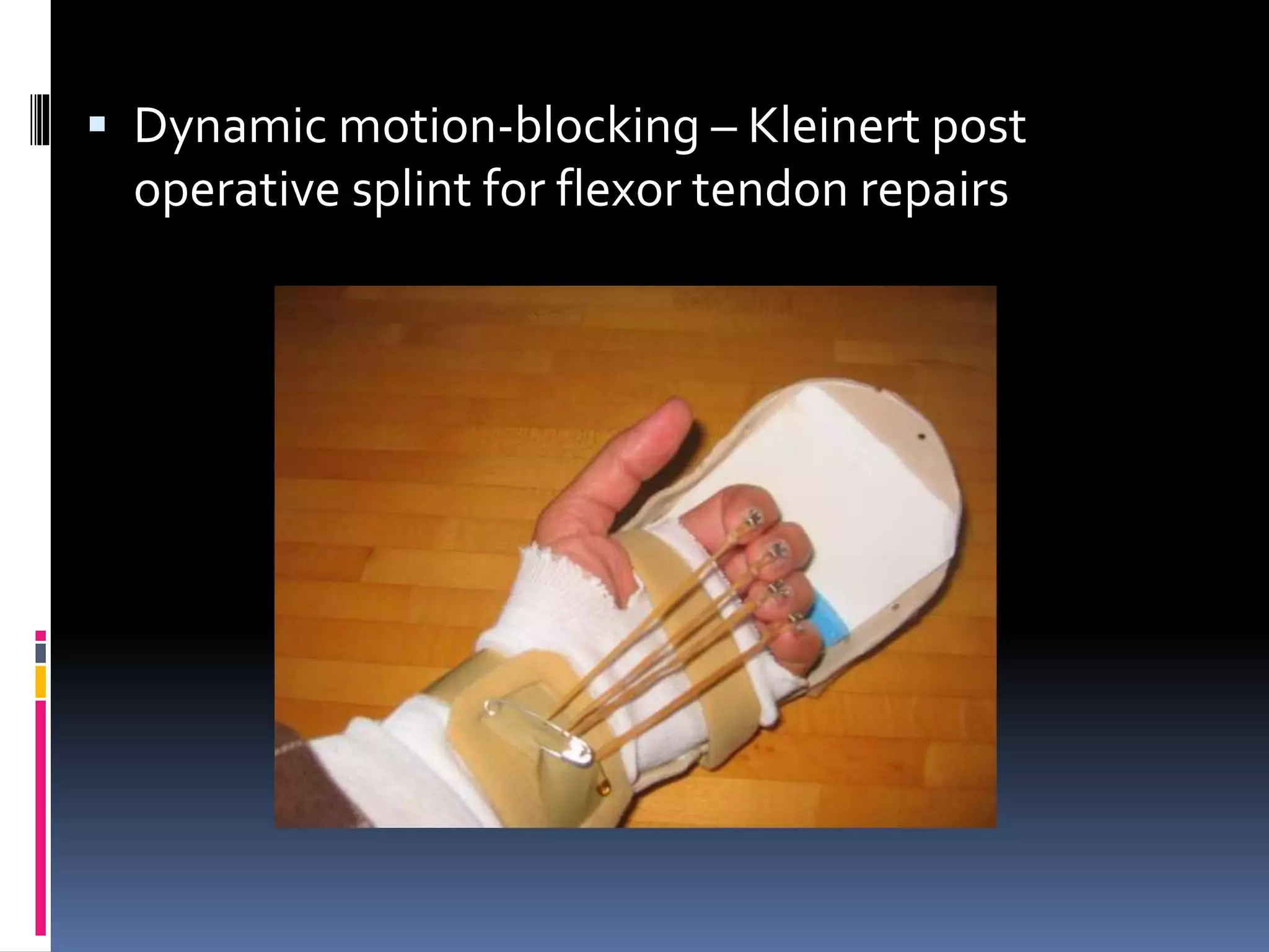 Upper limb orthosis | PPTX