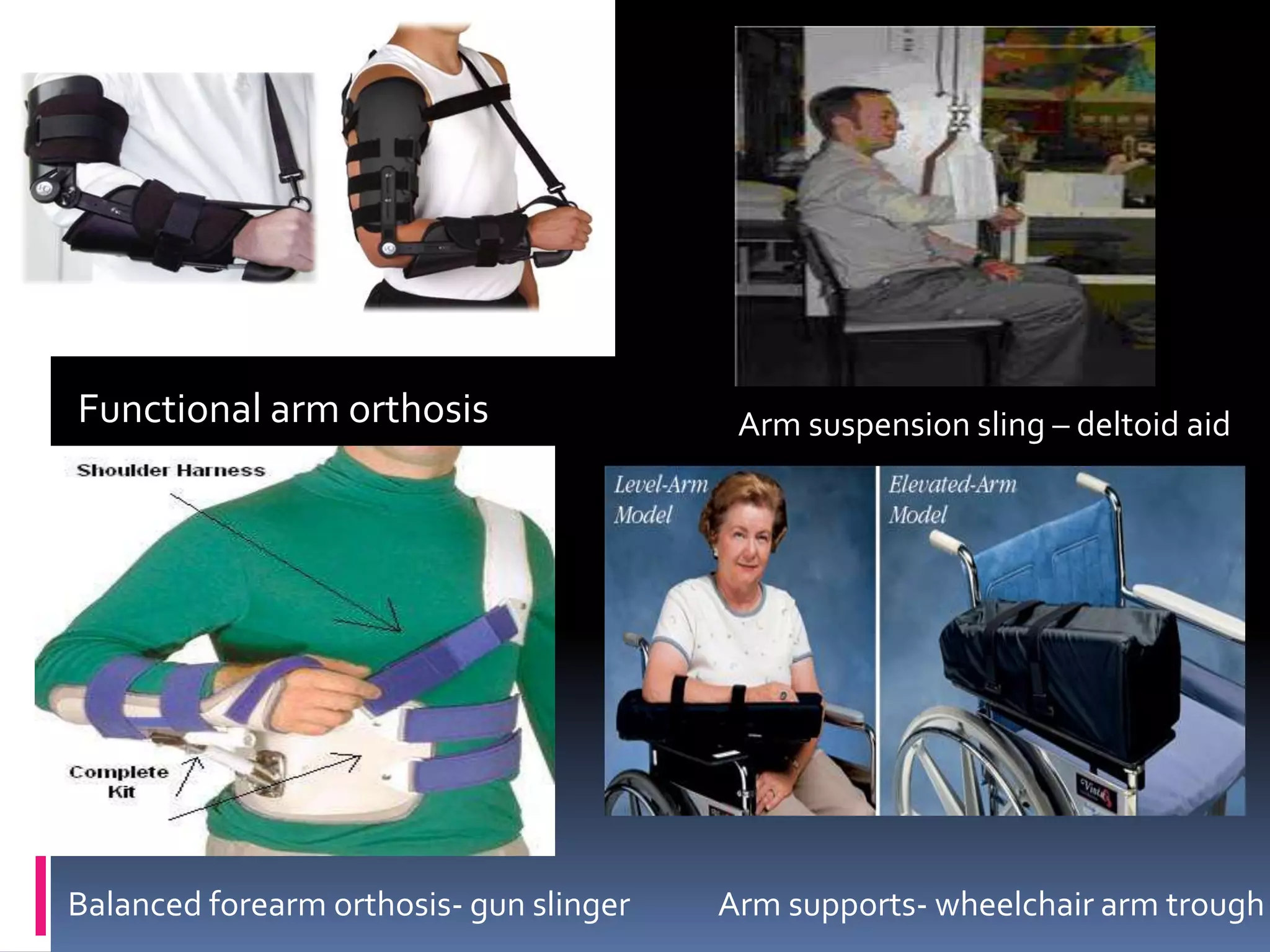Upper limb orthosis | PPTX