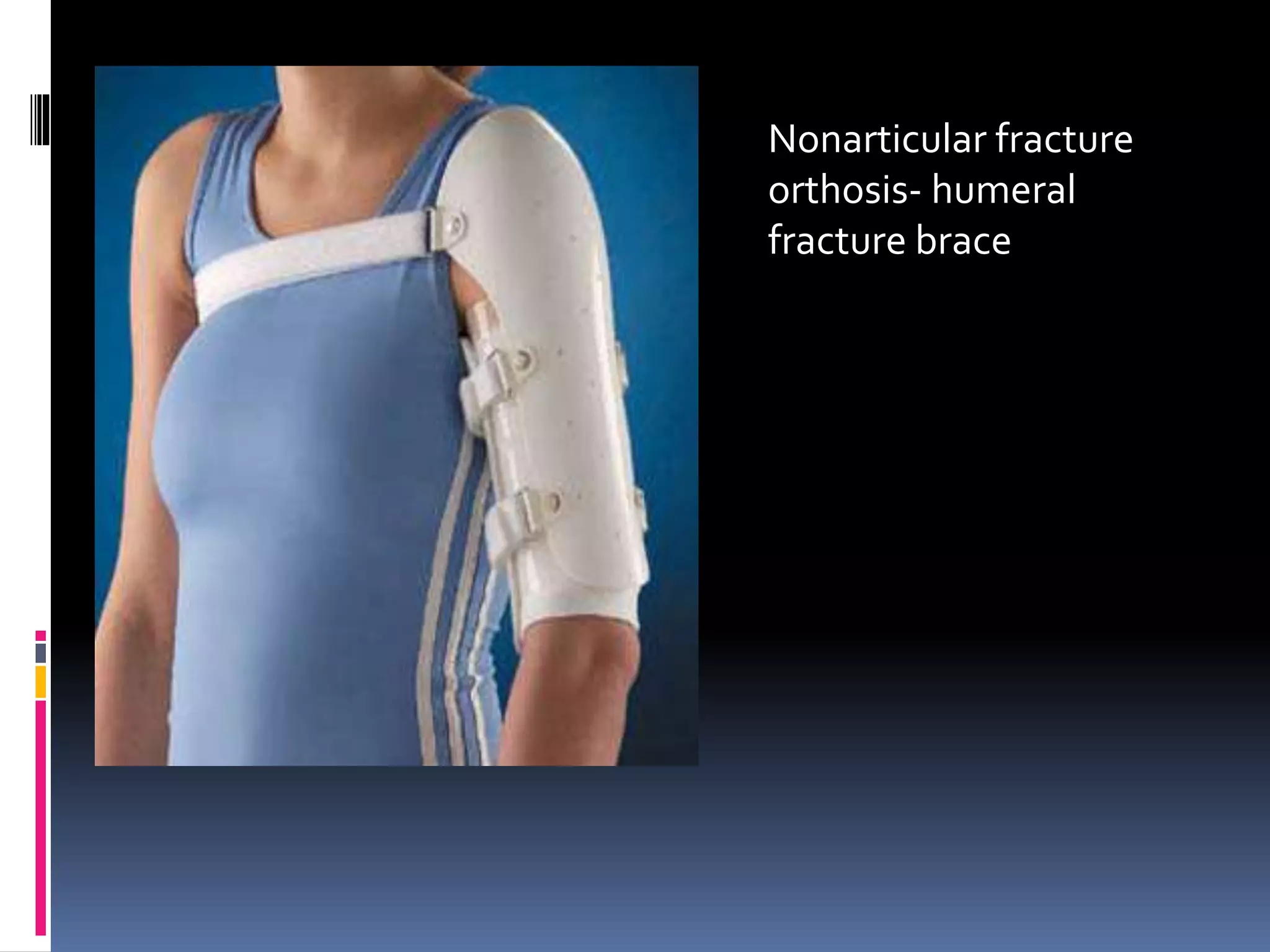 Upper limb orthosis | PPTX