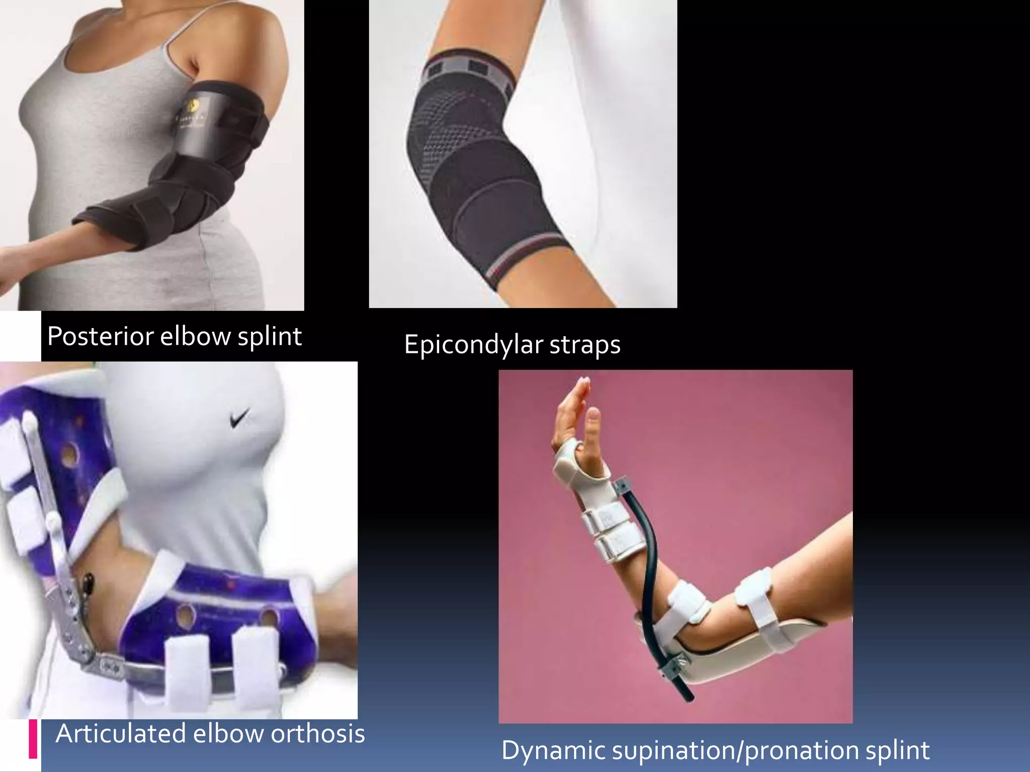 Upper limb orthosis | PPTX