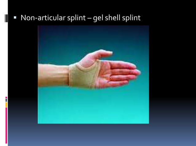 Upper limb orthosis | PPTX