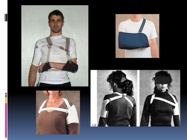 Upper limb orthosis | PPTX