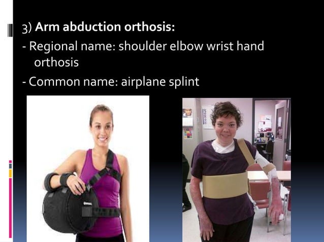 Upper limb orthosis | PPTX