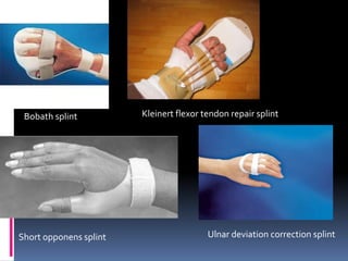 Upper limb orthosis | PPTX