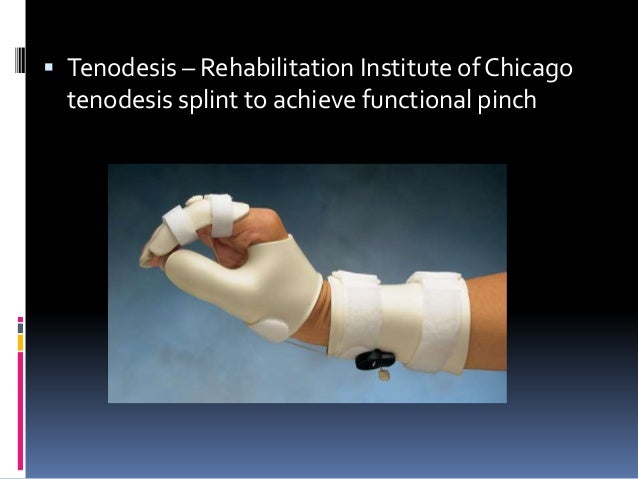 Upper limb orthosis