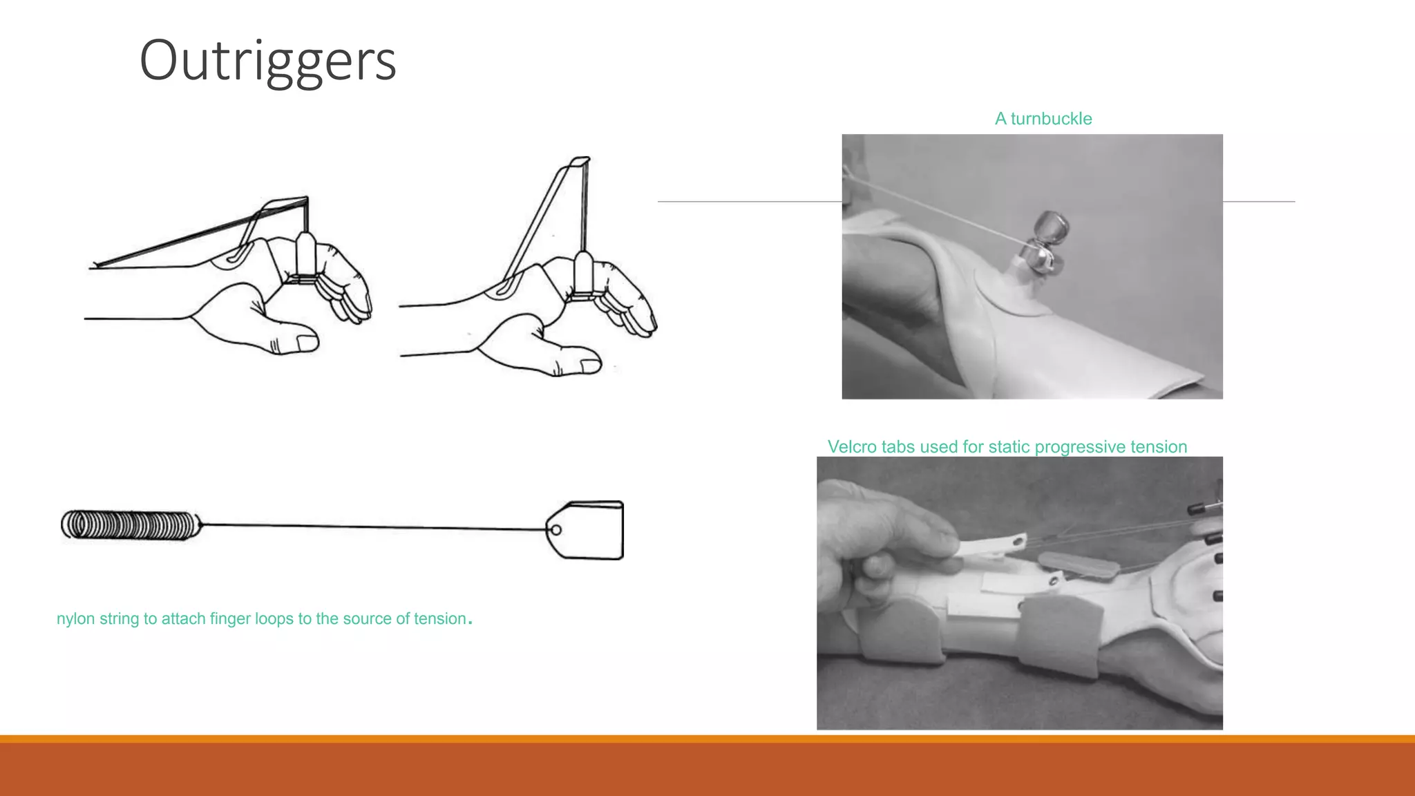 Upper Limb orthotic devices.pptx