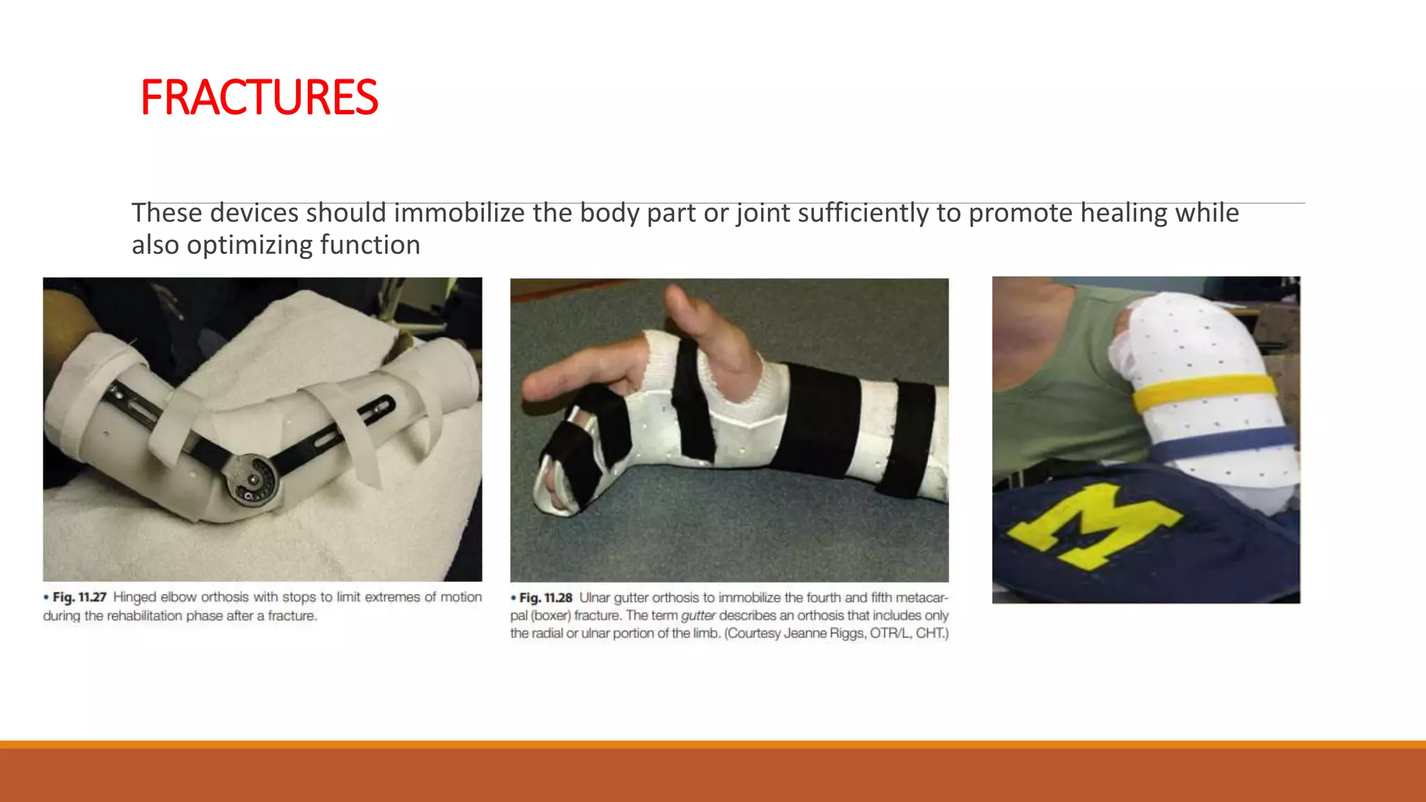 Upper Limb orthotic devices.pptx