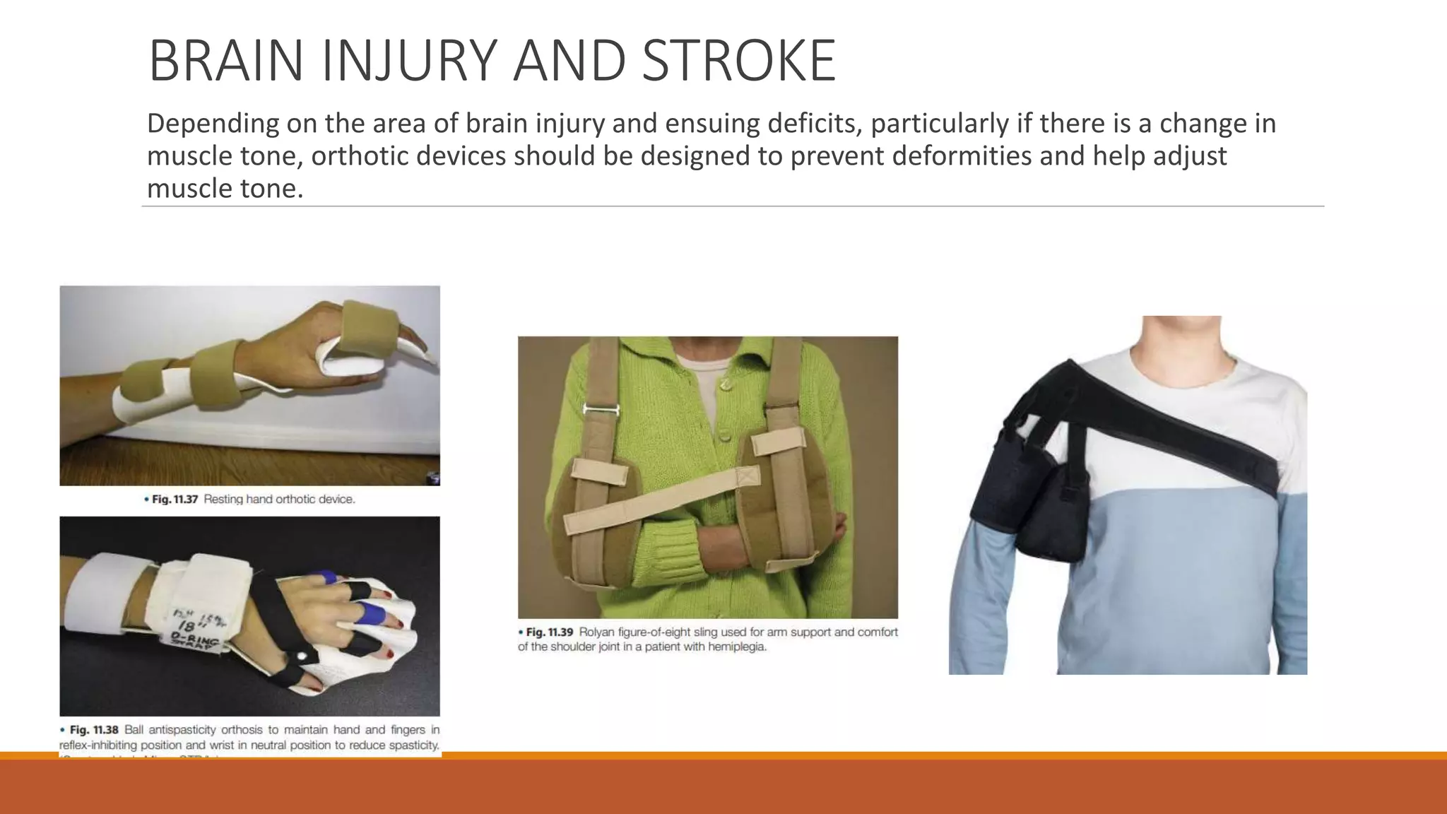 Upper Limb orthotic devices.pptx