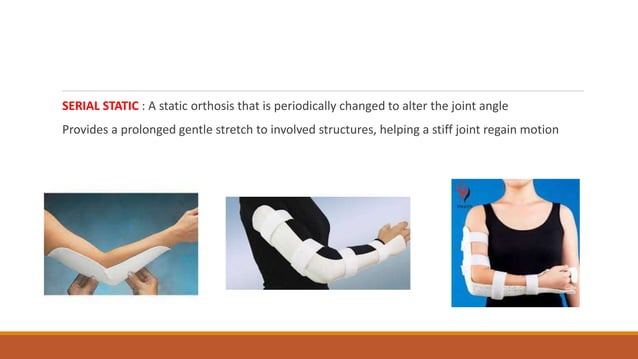 Upper Limb orthotic devices.pptx