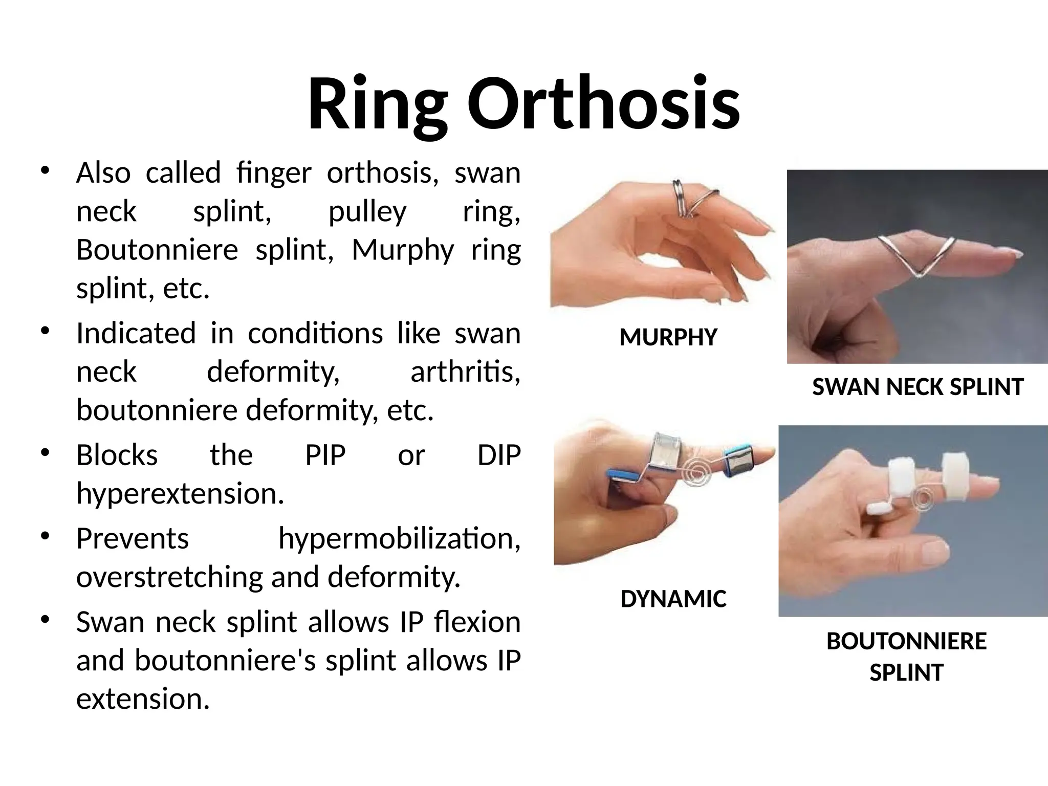 Upper limb Orthotic orthotics describing about the splints | PPTX