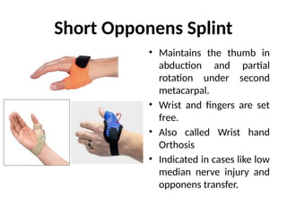 Upper limb Orthotic orthotics describing about the splints | PPTX
