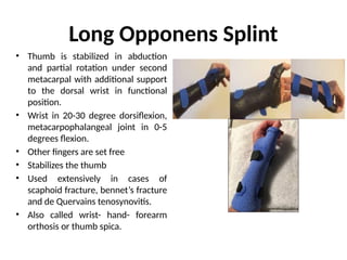 Upper limb Orthotic orthotics describing about the splints | PPTX