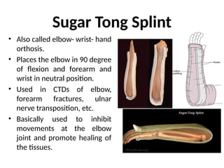 Upper limb Orthotic orthotics describing about the splints | PPTX